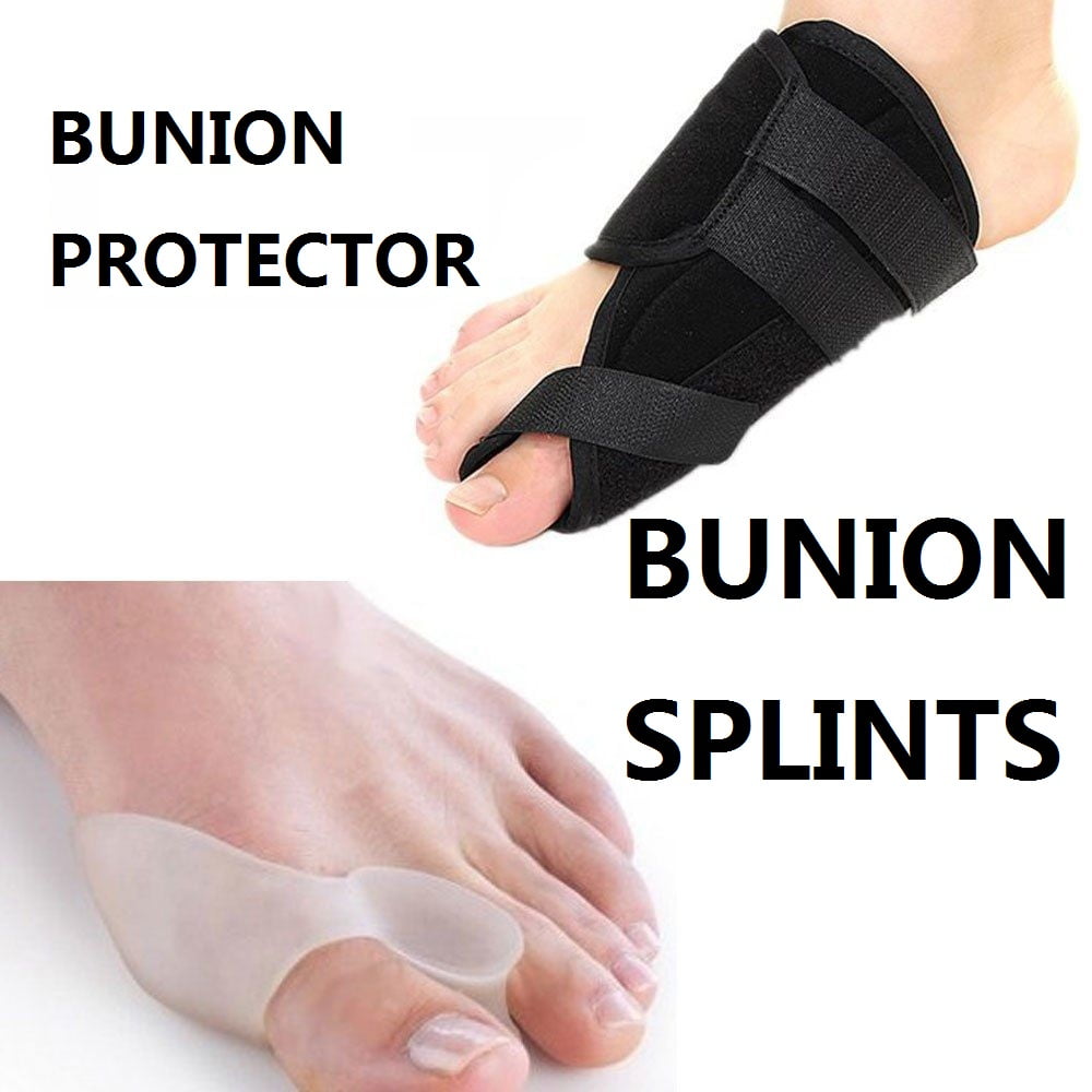 Hallux Valgus Bunion