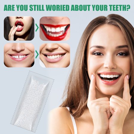 Temporary Dental Restoration, Thermal Bonding Beads for Restoring ...