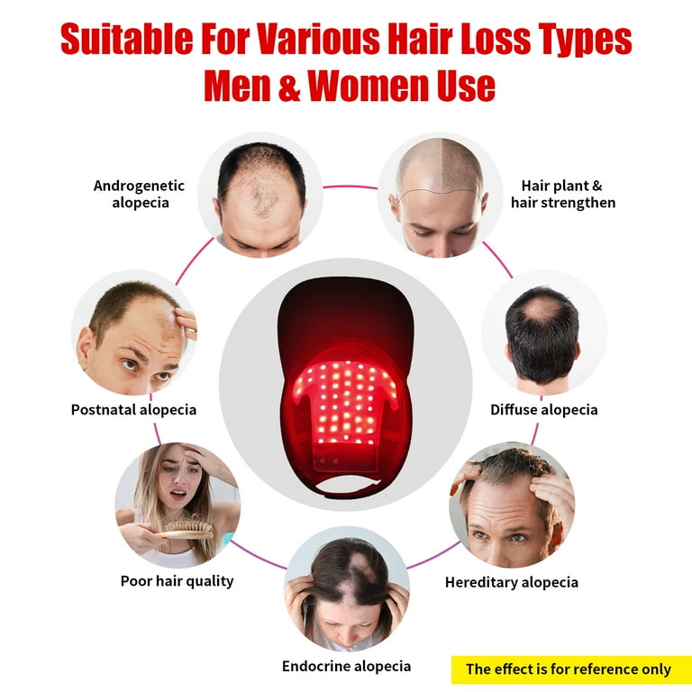 How To Use Red Light Therapy For Hair Loss | Shelly Lighting