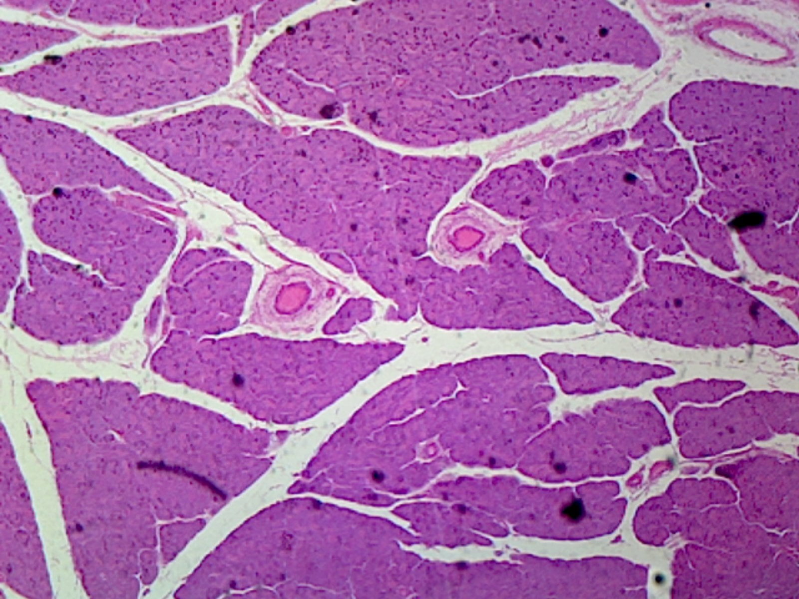 GSC International PS0148 Mammalian Pancreas Section - Microscope Slide ... GSC International PS0148 Mammalian Pancreas Section - Microscope Slide ...