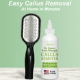 EntreFeet Callus Remover Gel and Foot File 4 oz Extra Strength for Feet ...