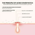 Acne Patch Pimple Patch 5 Colors Star Shaped Acne Absorbing Cover