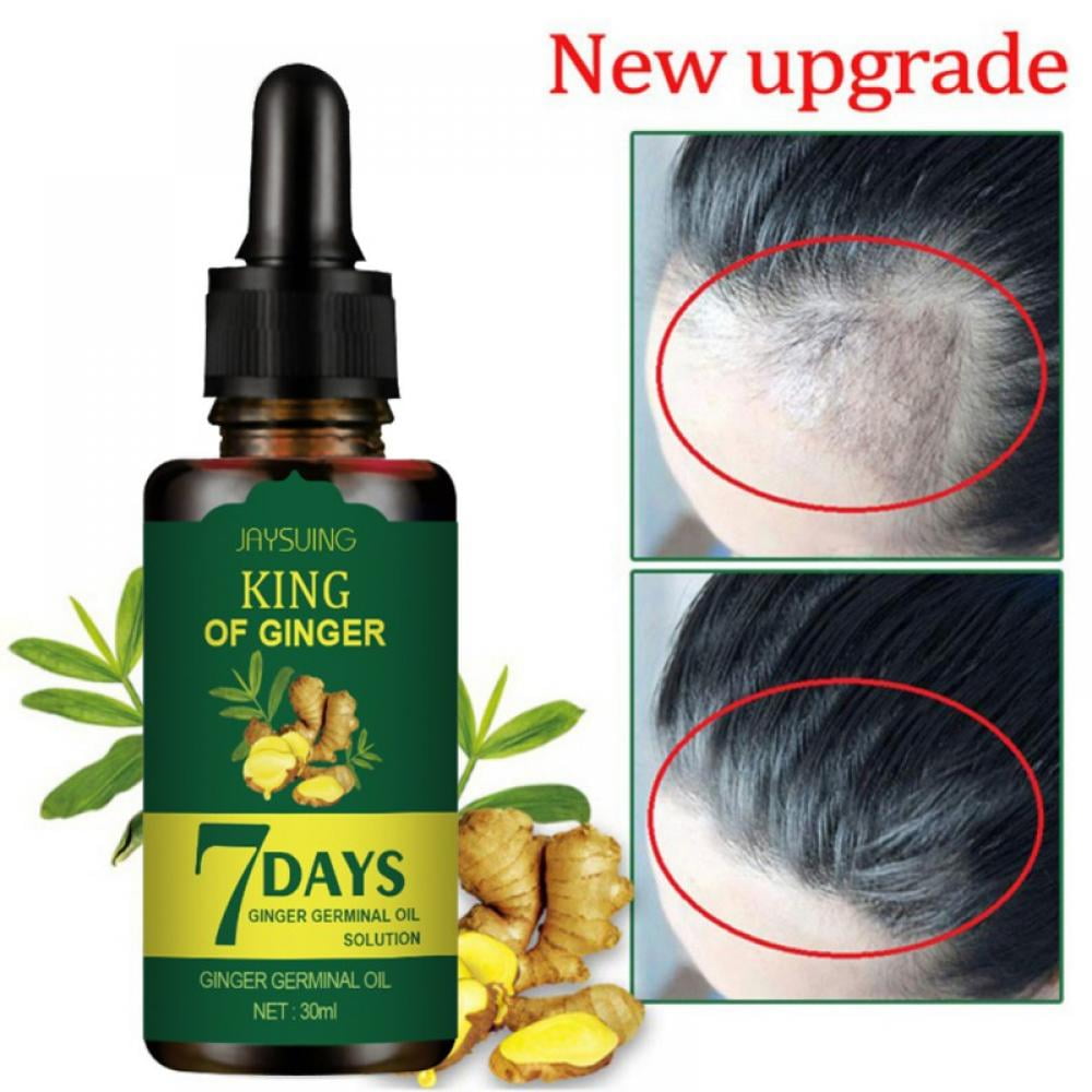 Hair Growth Serum 7 Day Ginger Germinal Serum Essence Oil Loss