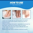 Nail Fungus Cleaning Laser Pen,Nail Fungus Cleaning Laser Device Nail ...