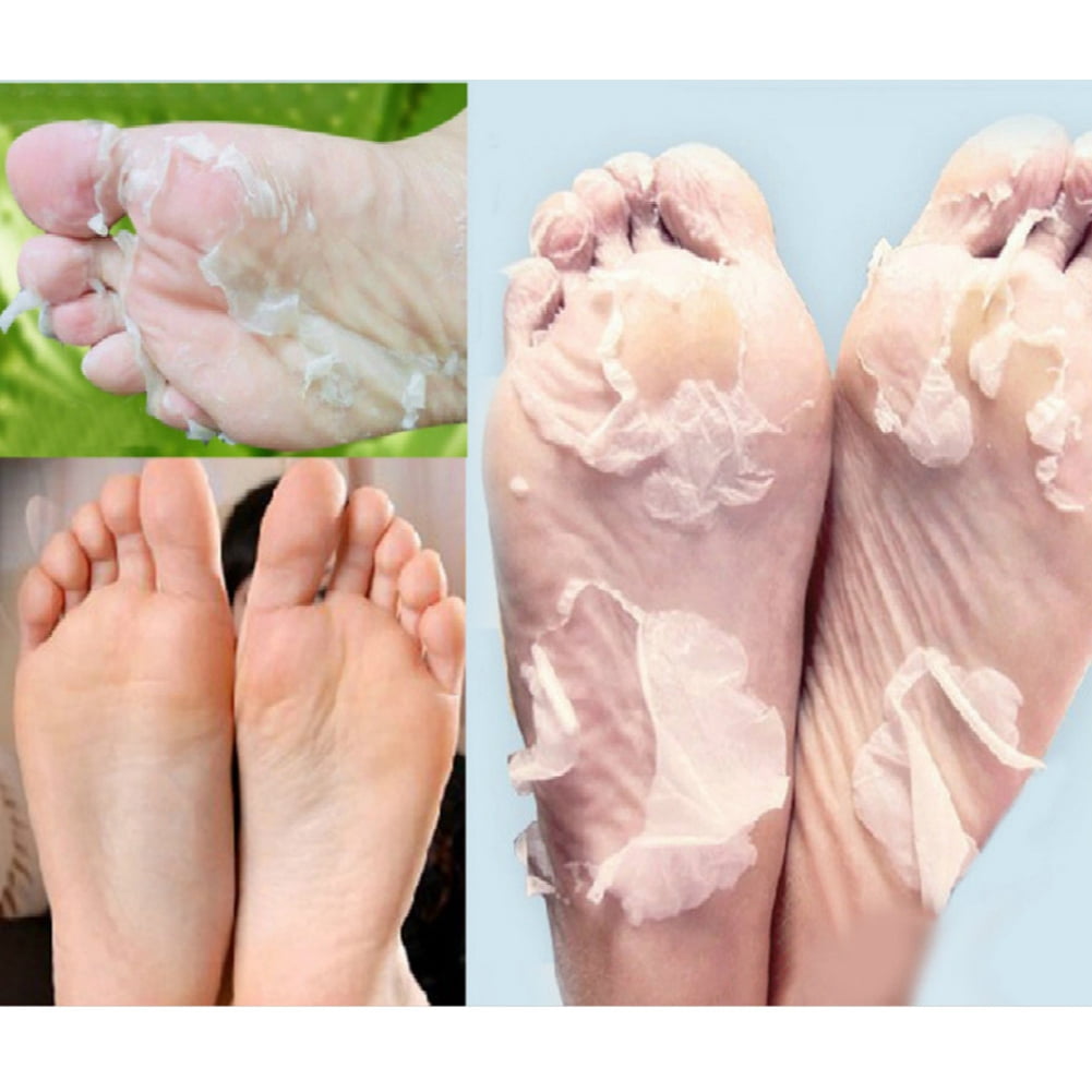Foot Exfoliating 5 Pcs/set, Exfoliating Booties For Peeling Off ...
