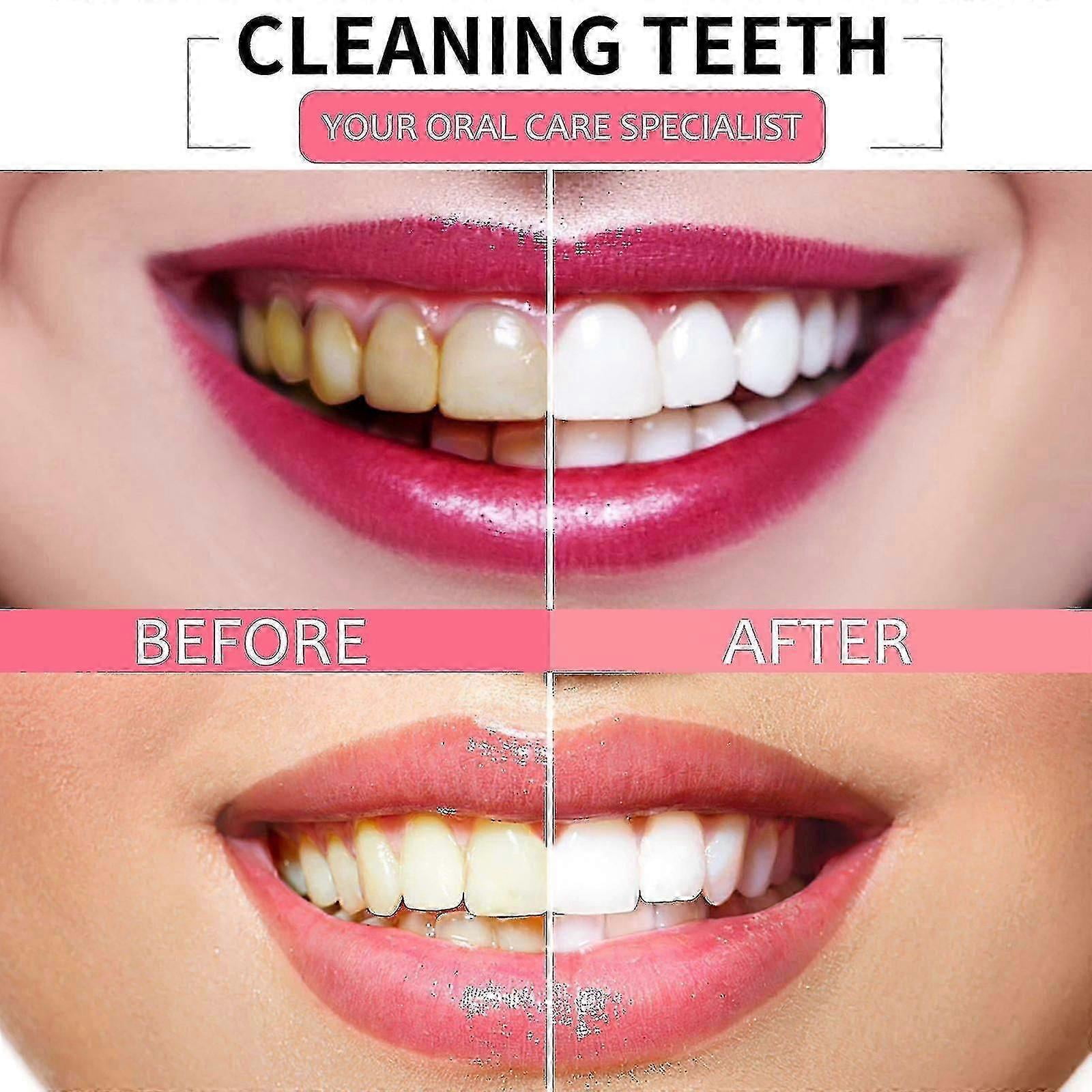 Jaysuing Toothpaste Whitening Teeth Stain Removal Fight Bleeding Gums ...