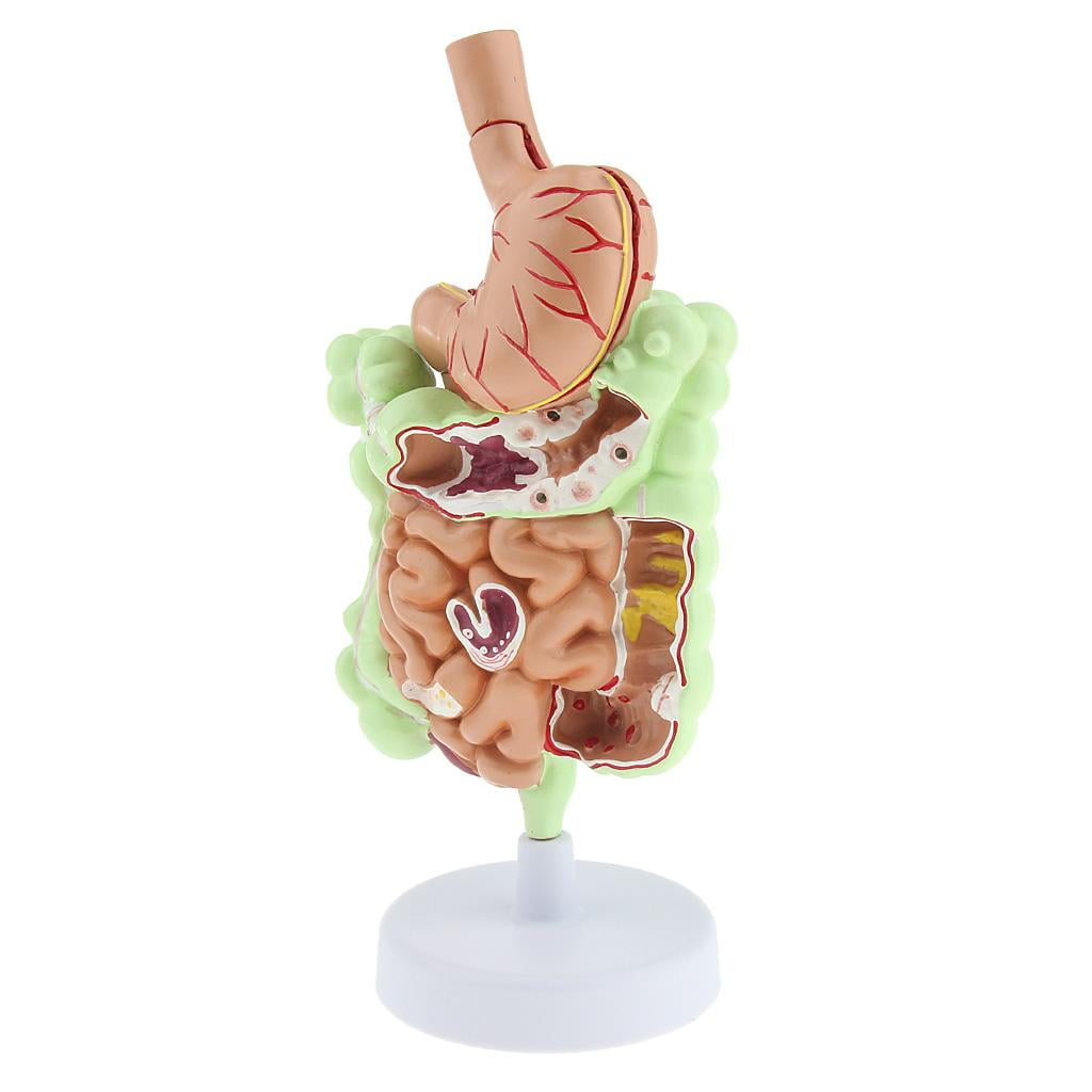 Human Stomach Gastrointestinal Digestive System Model Teaching ...