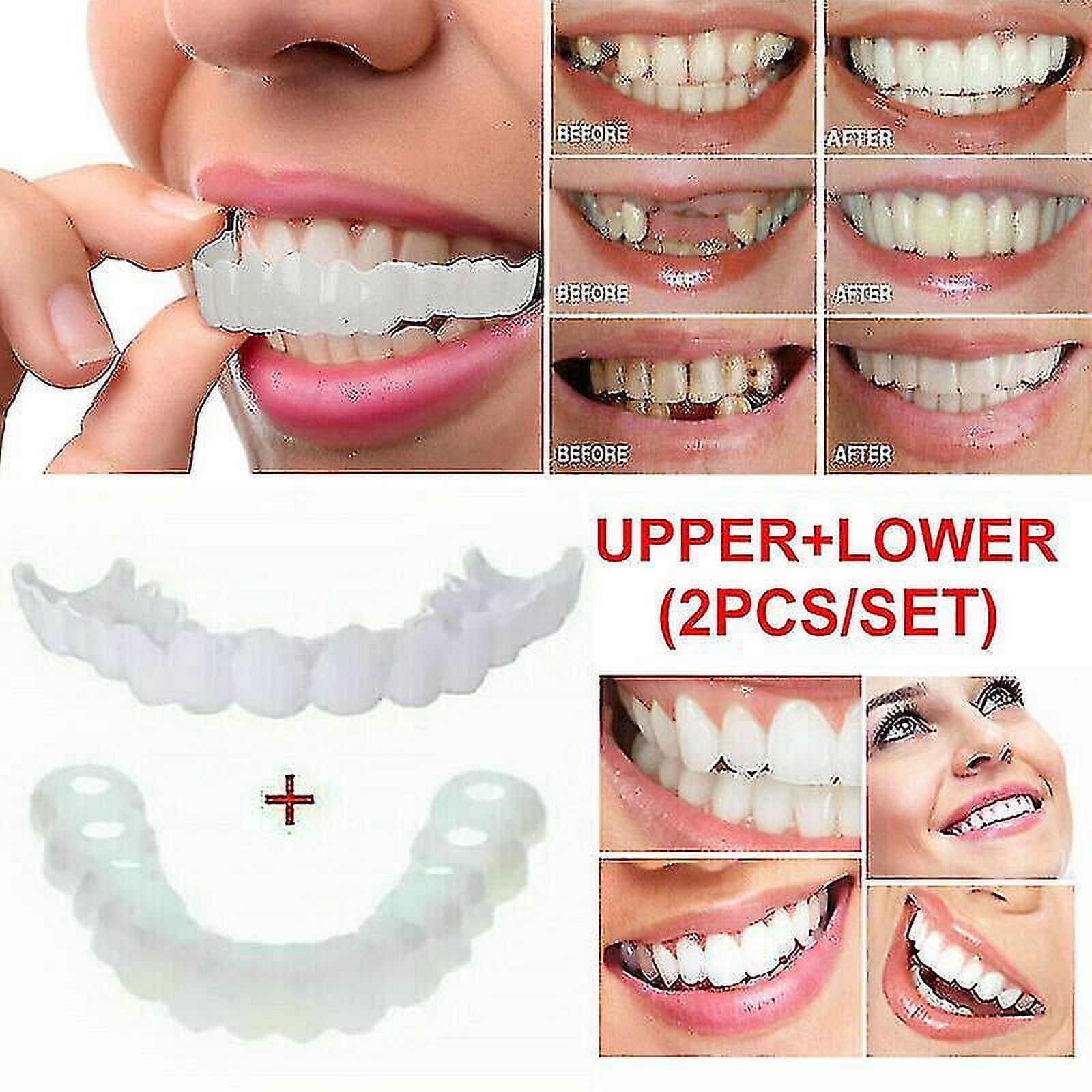 Teeth Covers Uk
