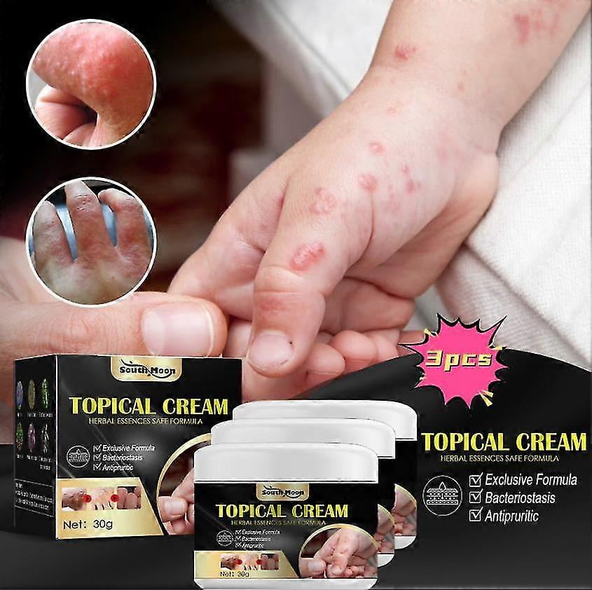 Crema antipicazón South Moon para ampollas, manos y pies, piel seca con ...