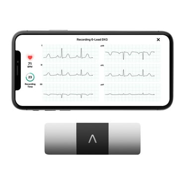 EMAY Bluetooth EKG Machine | Portable ECG Monitor for iPhone, Android ...
