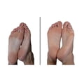 Emjoi Micro-Pedi Callus Remover with Bonus Replacement Rollers for Feet ...