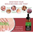 1 3pcs 7 Days Nails Care Repair Nail Fungal Anti Fungus Onychomycosis