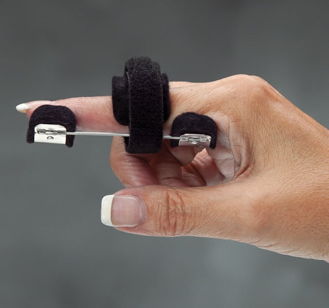 Serial static splint - inputrecord