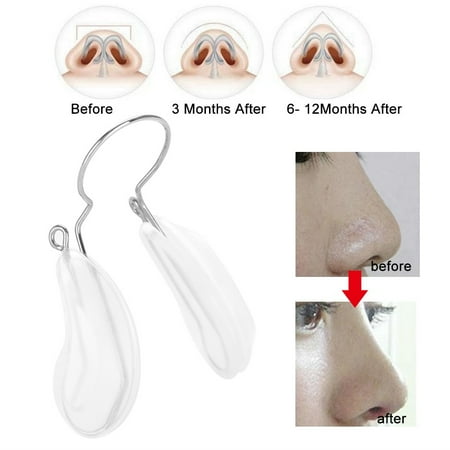 Nose Shaper Nose Up Shaper Nose Shaping Clip Nose Straightening Clip ...