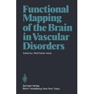 Deep Brain Stimulation Programming: Mechanisms, Principles and Practice ...