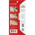 Clozex Emergency Laceration Closures - Repair Wounds Without Stitches ...