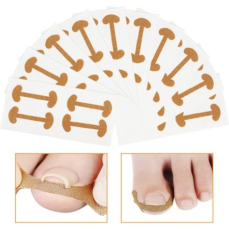 HEIBIN 10 Pack Paronychia Nail Correction Stickers Ingrown Toenail ...