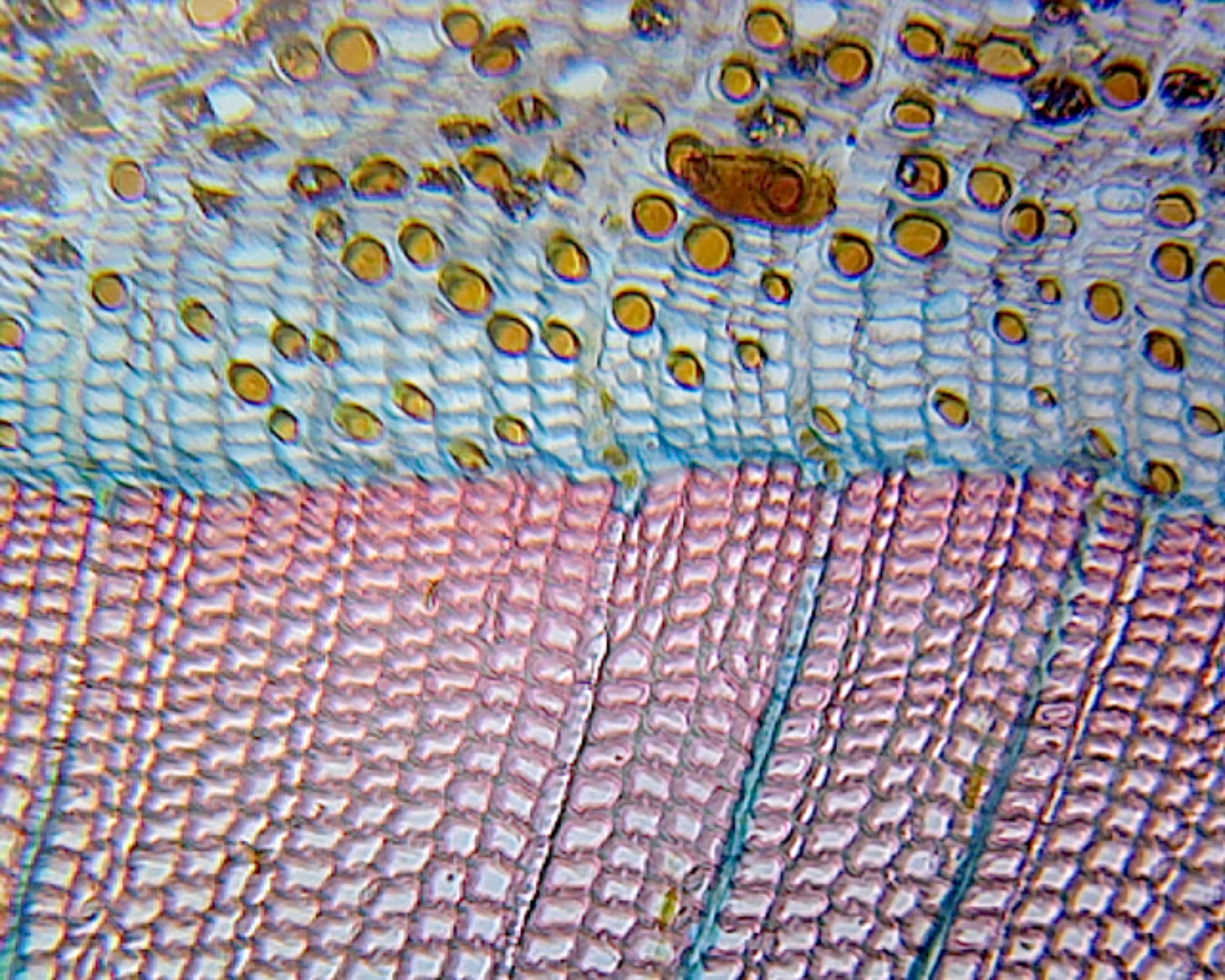 Pine Mature Stem; Showing Annual Rings and Resin Ducts; Cross Section ...