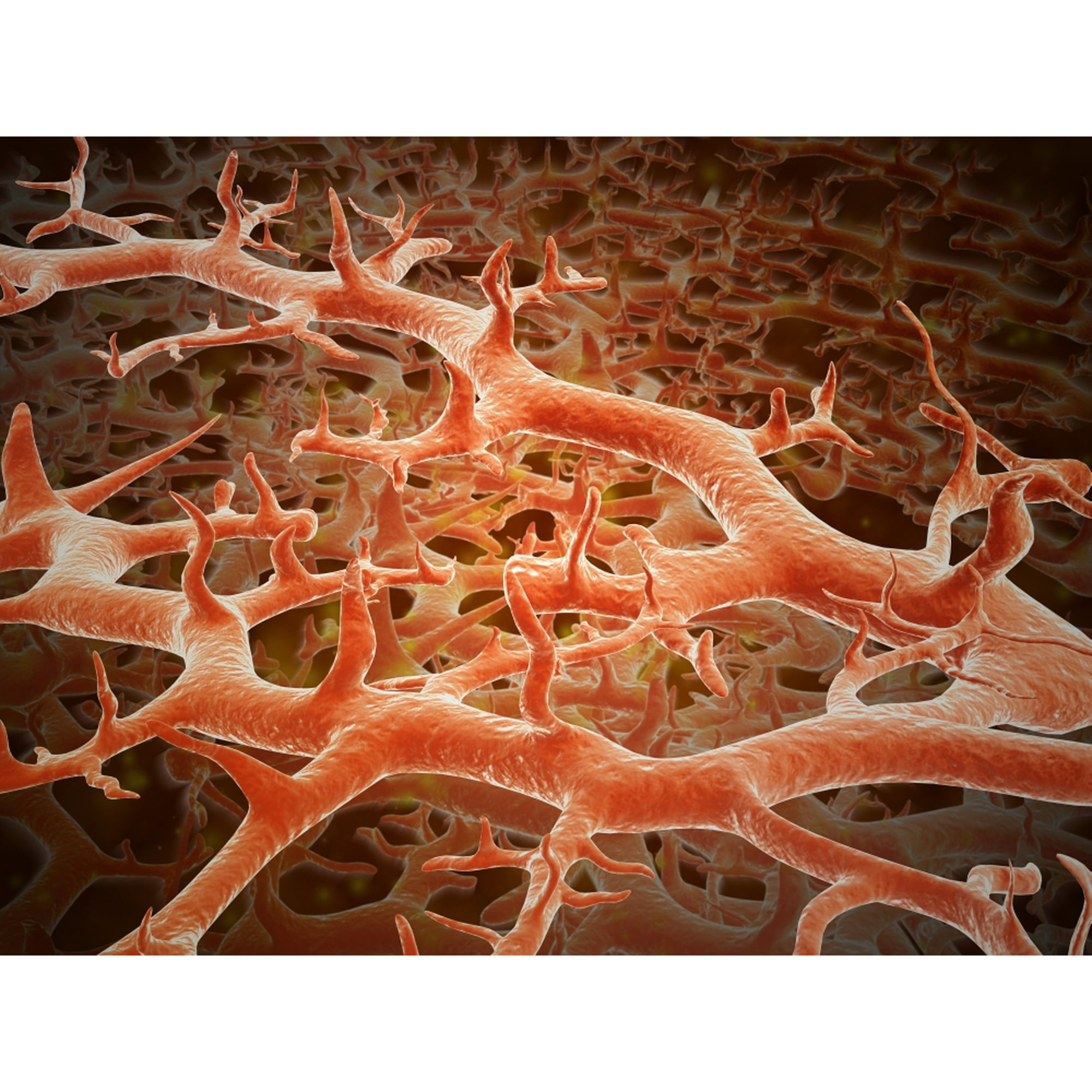 Tinea Pedis Microscope