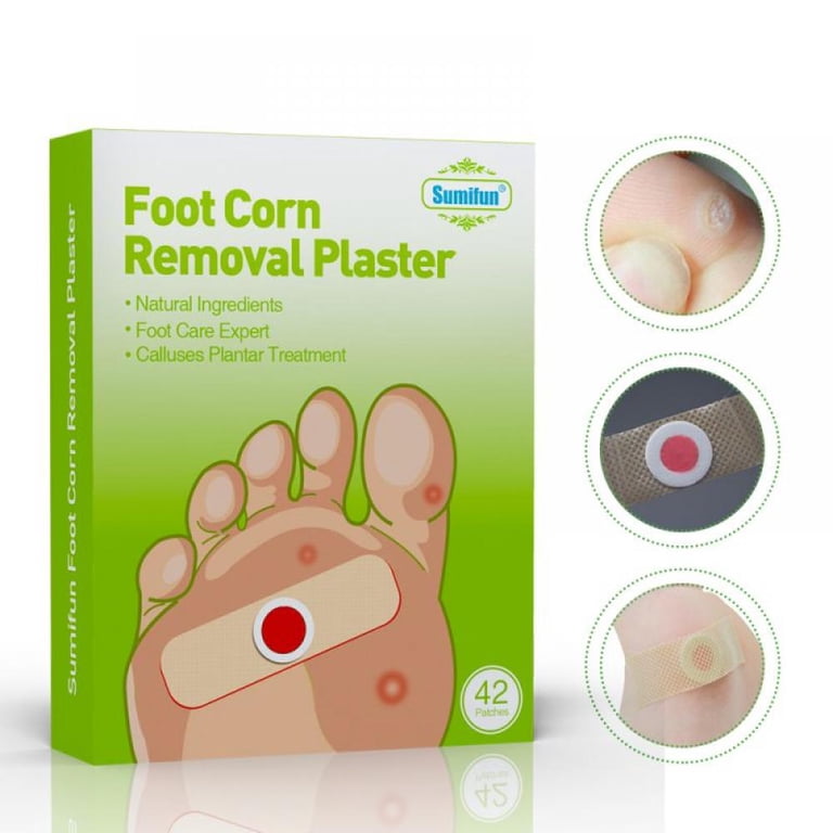 Calluses Between Toes | ppgbbe.intranet.biologia.ufrj.br