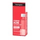 Neutrogena Stubborn Acne Spot Drying Acne Treatment, 10% Sulfur, 1 oz ...