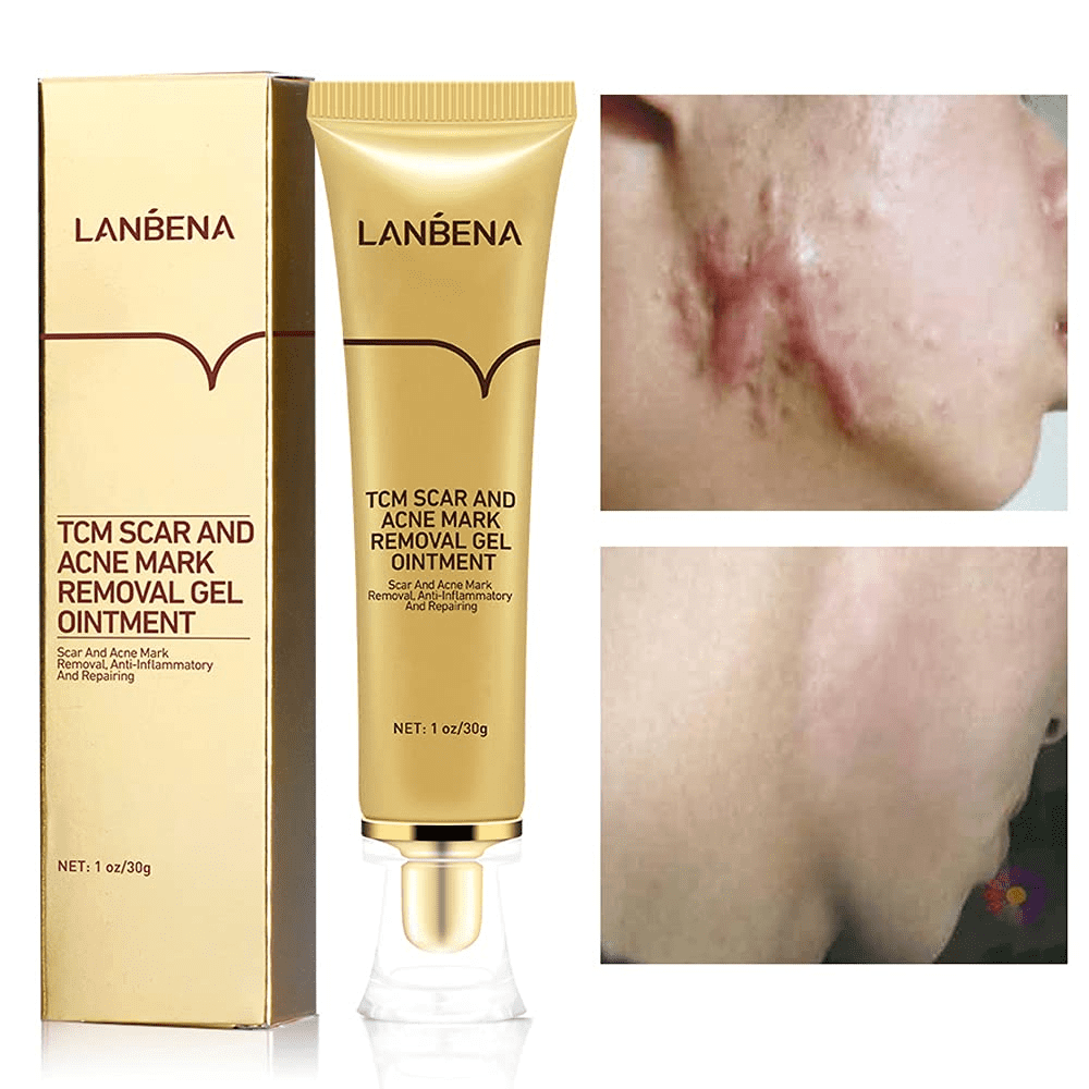 Acne Scar Removal Cream Stretch Marks Face Skin Cream Shrink Pores Gel ...