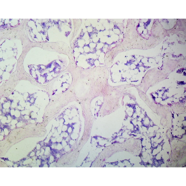 Spongy Bone Slide Labeled