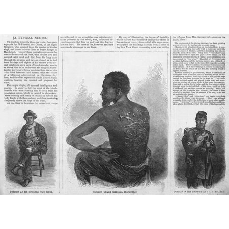 An African American Runaway Slave Named Gordon Entered The Union Army ...