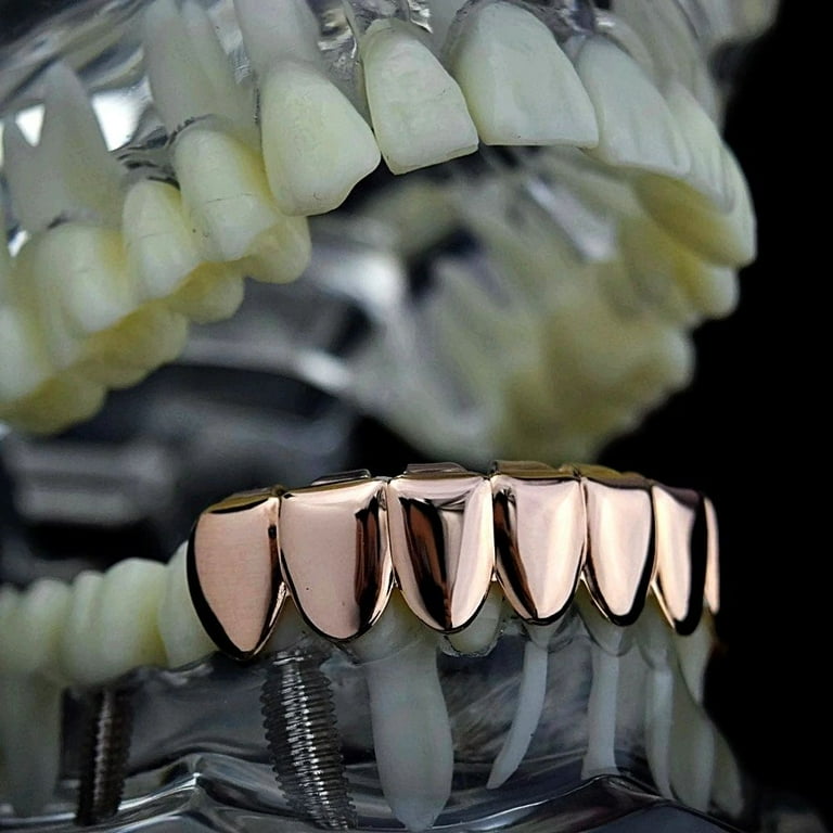 Rose Gold Teeth