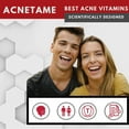 Acnetame Acne Pills 30 Day Supplements For Acne Vitamin Treatment