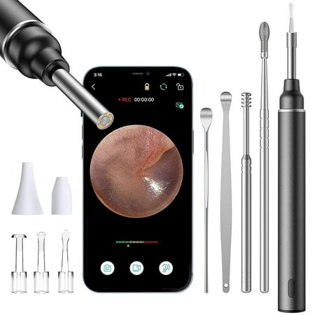Digital Otoscope WiFi Earpick Camera Visual Endoscope, Ear Scope with ...