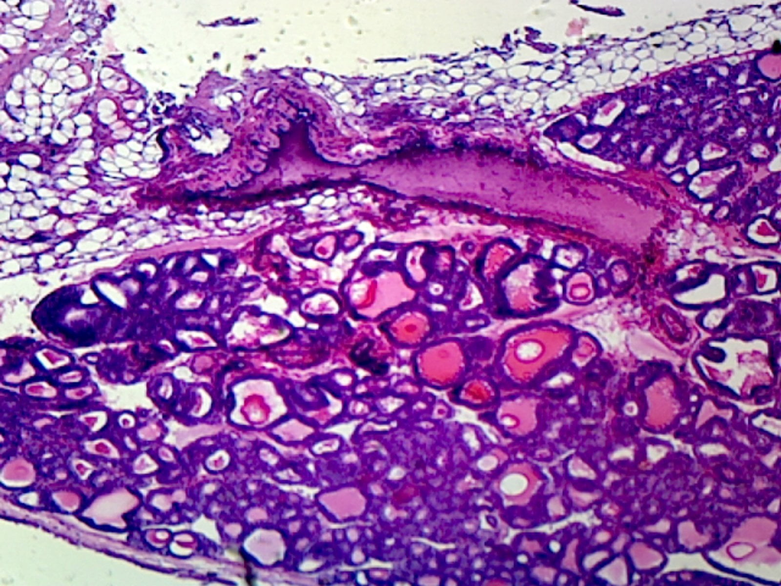 Gsc International Ps0173 Mammalian Umbilical Cord Section Microscope Side
