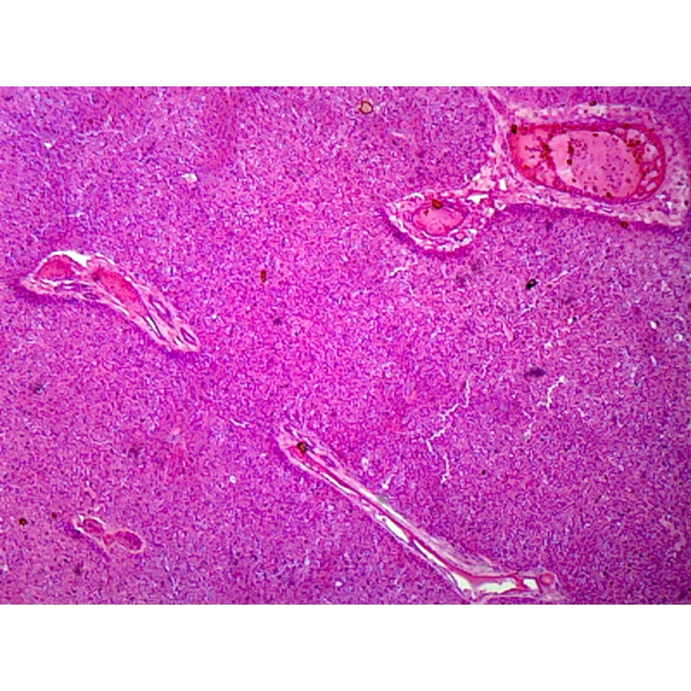 Liver, Mammalian; Showing Hepatic Cells; Section; H&E Stain - Walmart ...