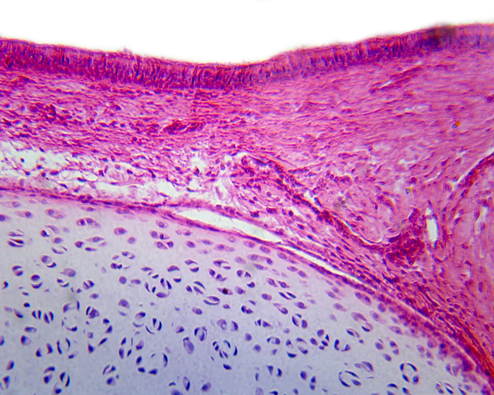 GSC International PS0150 Ciliated Pseudostratified Columnar Epithelium ... GSC International PS0150 Ciliated Pseudostratified Columnar Epithelium ...