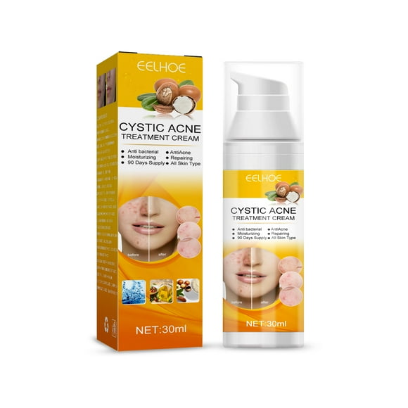 Treatment Cystic Acne