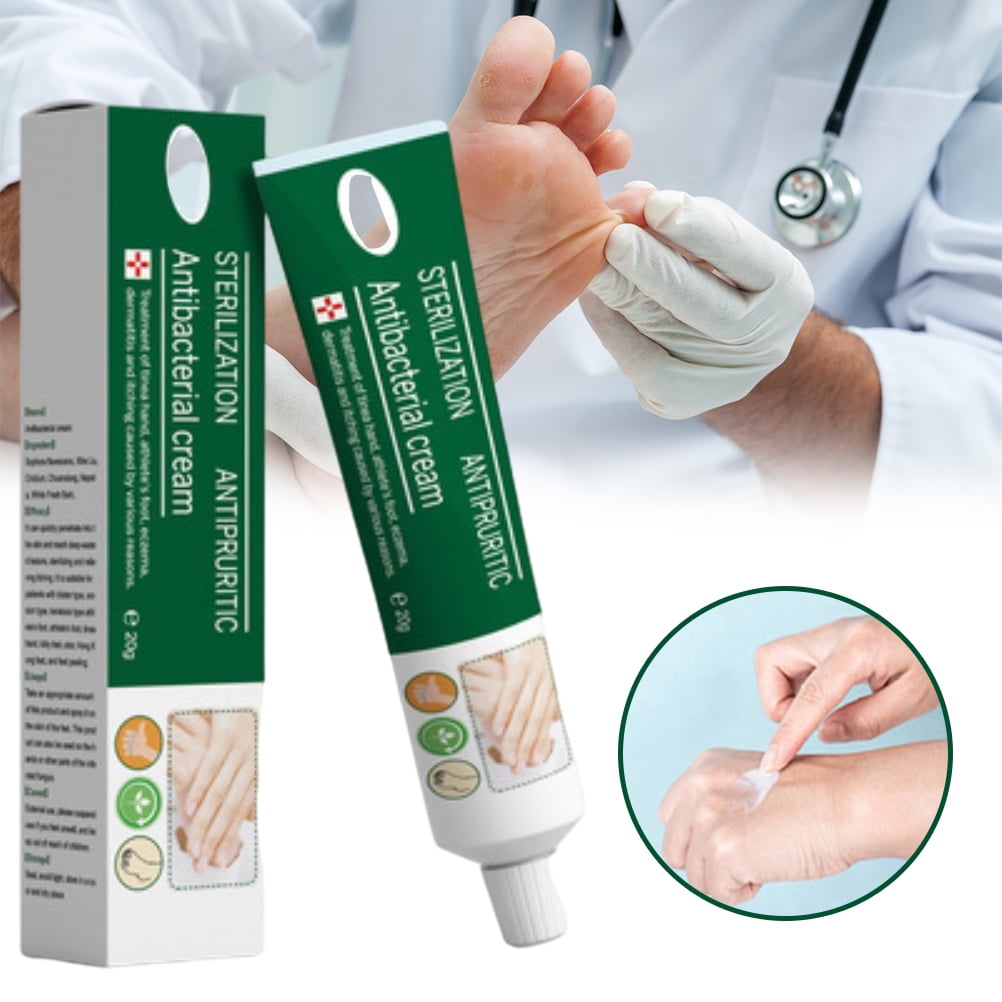 20 g Crema para manos y pies contra hongos para aliviar la picazón, la ...
