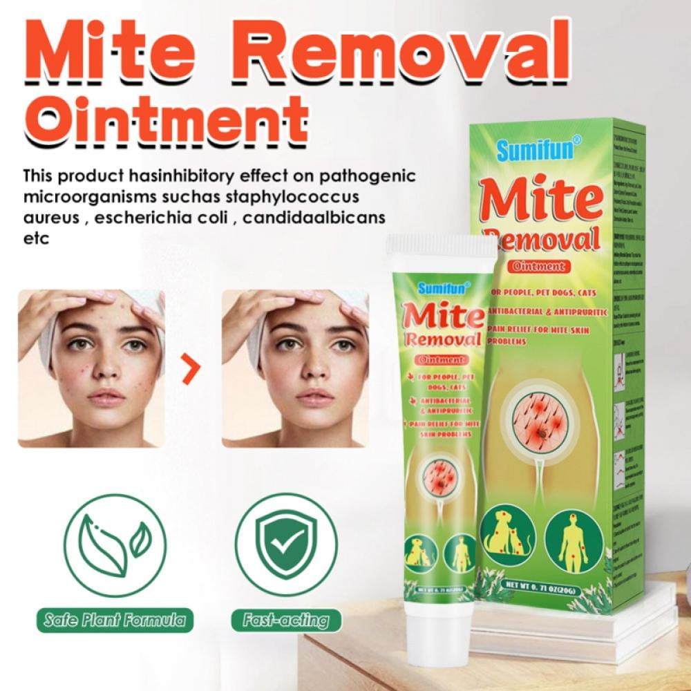 Itch Relief Cream Removing Human Mites Skin Care Ointment Herbal for ...