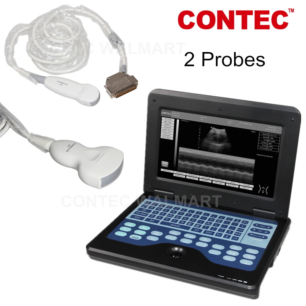 Buy B-Ultrasound Machine portable laptop digital Ultrasound Scanner ...