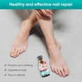 Toenail Fungus Treatment Extra Strength Nail Fungus Solution for ...