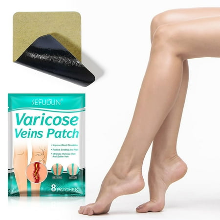 Surrme 24pc Varicose Veins Patch Plaster Medical Patch Spider Veins ...
