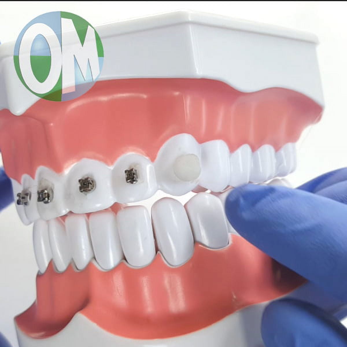 Pk of 100 - Orthodontic Orthowax Plus Precut For Nepal | Ubuy