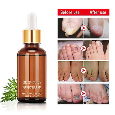 30ml Herbal Nail Care Essence Moisturizing Nourishing Nail Liquid for ...