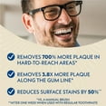 Spinbrush Smart Clean Battery Powered Electric Toothbrush, Soft ...