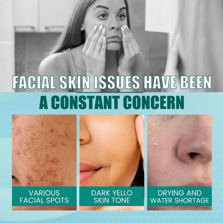 Dry Skin Patches On Face | visitchile.cl