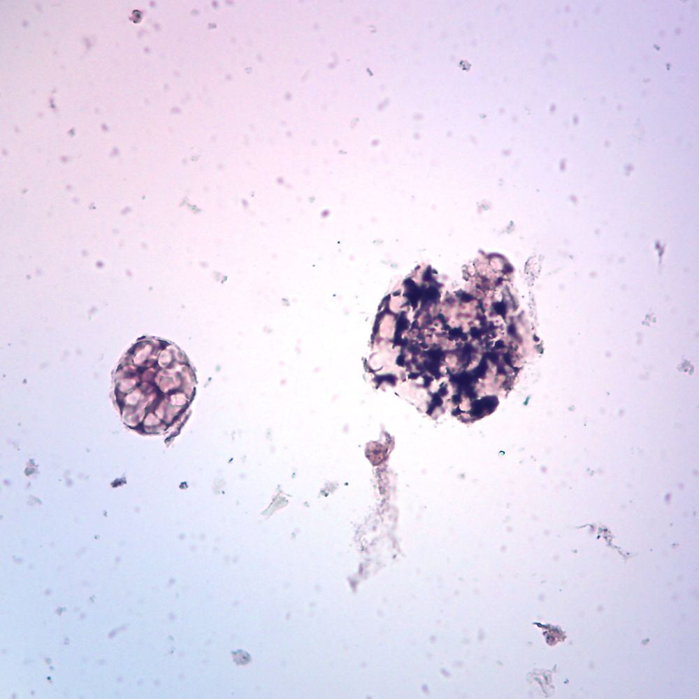 Trichomonas Slide