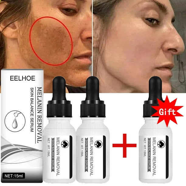 Suero antienvejecimiento para eliminar manchas oscuras, crema blanqueadora de pecas, aclara la ...