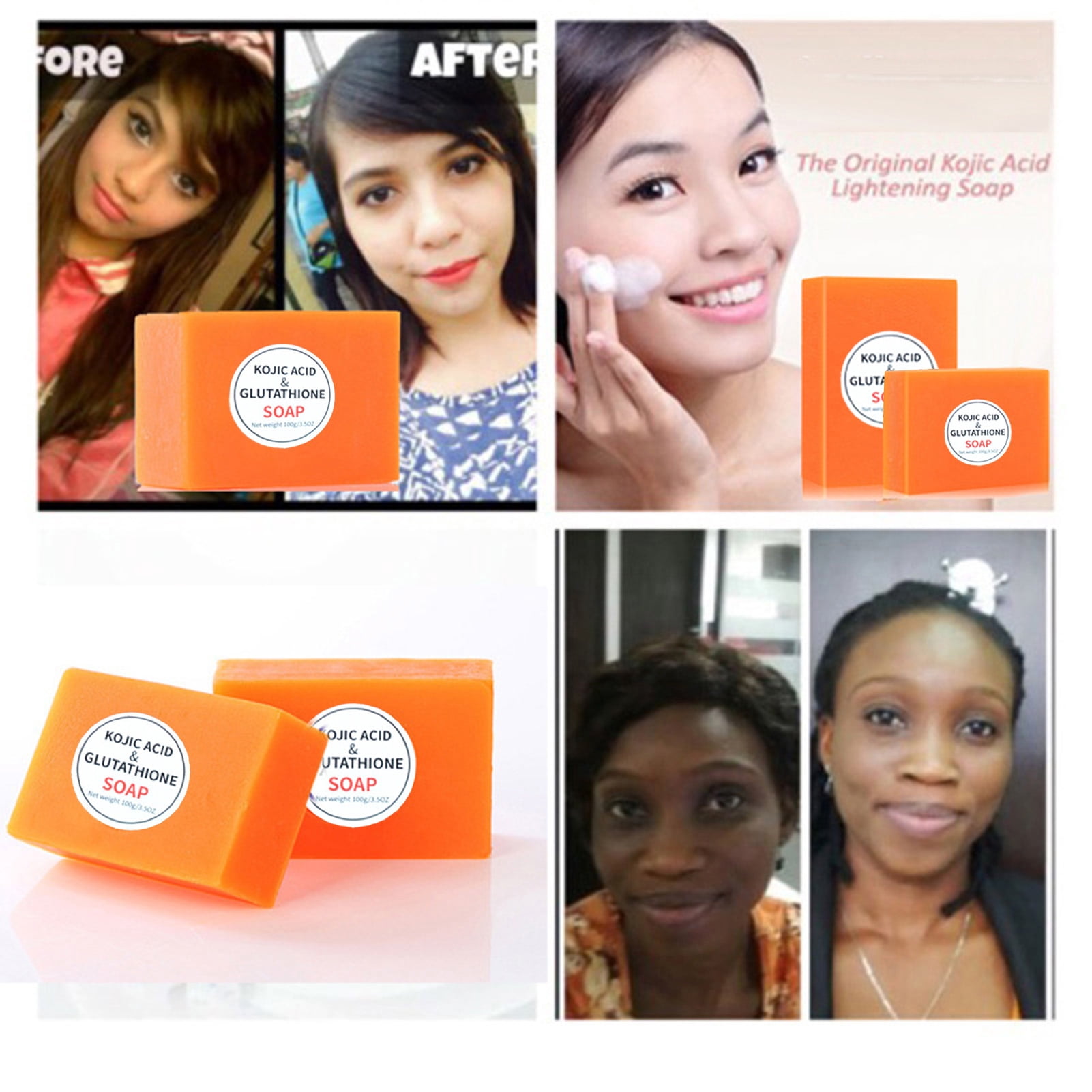Glutathione Soap Before And After