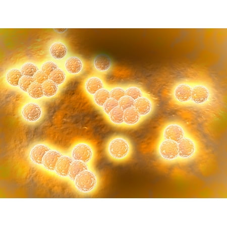 Microscopic view of Methicillin-resistant Staphylococcus aureus Poster ...