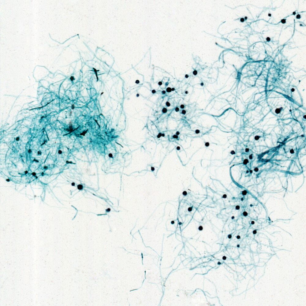Water Molds Microscope