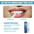 Teeth Gum Gel Teethwhitening Cleaning Pen Teeth Gel Teeth Pen Gel Teeth ... Teeth Gum Gel Teethwhitening Cleaning Pen Teeth Gel Teeth Pen Gel Teeth ...